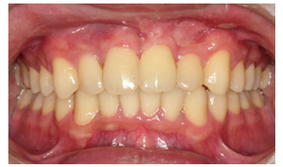 Before & After | Twaddle Orthodontics Columbia, MO